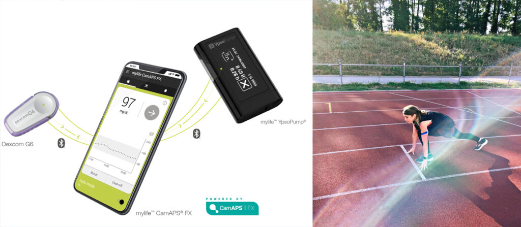 Start des Produkttests: mylife Loop