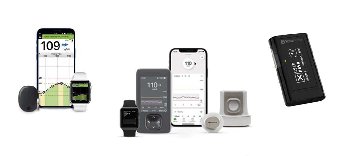 Neues zu mylife YpsoPump, Dexcom und Eversense