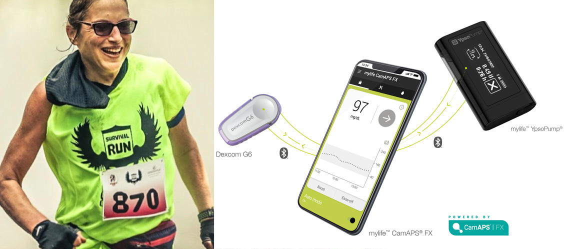 Los geht's: Erste Erfahrungen mit mylife Loop
